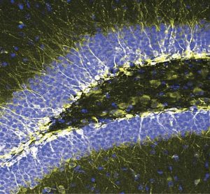 Tuberculosis: Researchers uncover how bacteria burst our cells